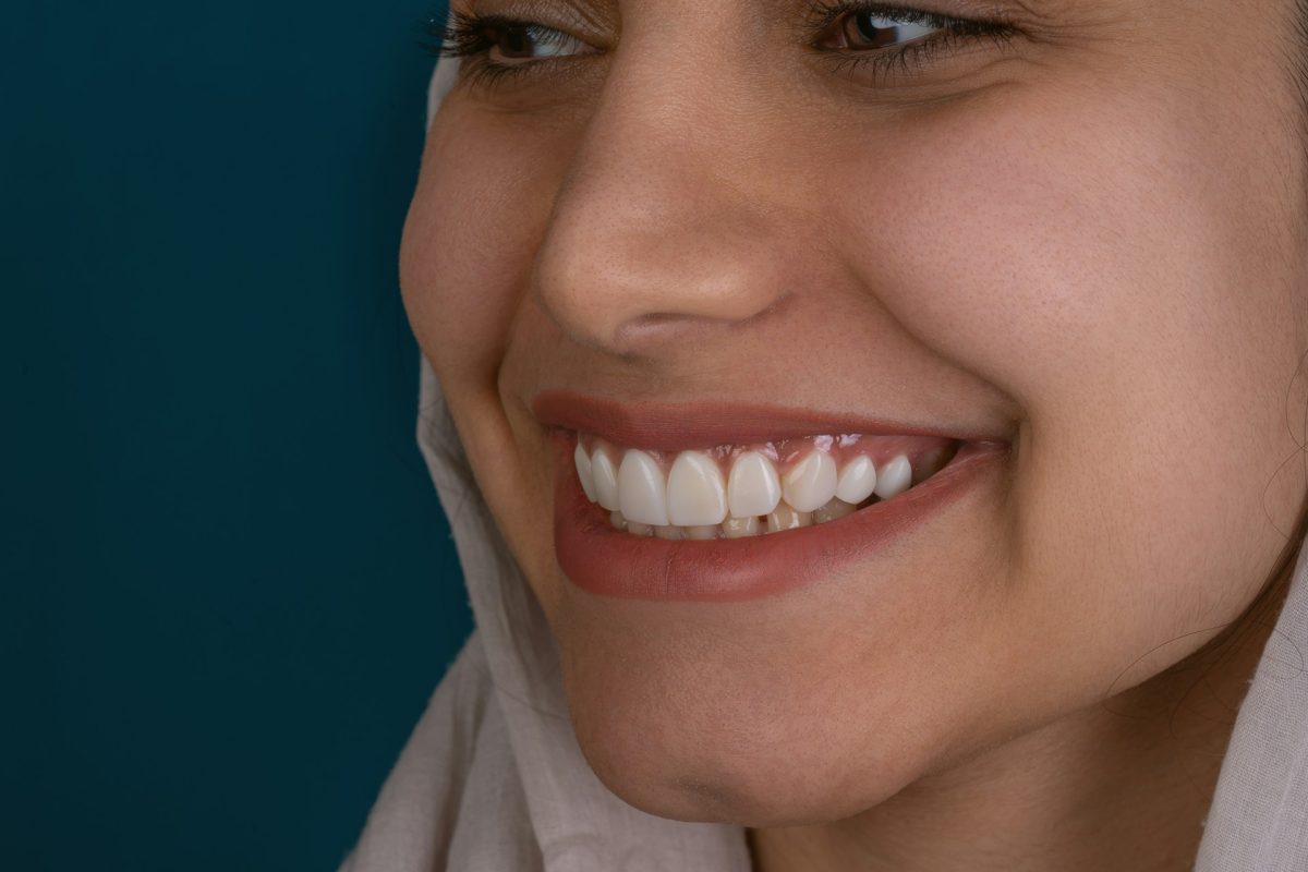 Bleeding Gums: Causes, Prevention & Treatment | Star Dental
